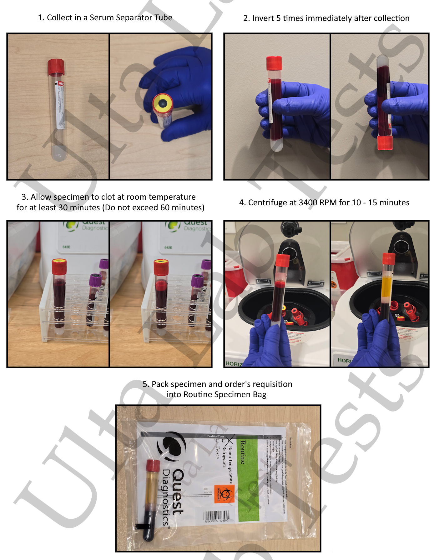 Ferritin Iron And TIBC Panel Ulta Lab Tests Ferritin Iron And TIBC Panel Ulta Lab Tests
